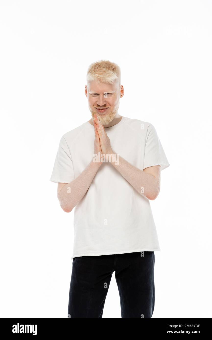 Albino Man Tall Parents Of Albino Black Twins Are Sick Of People