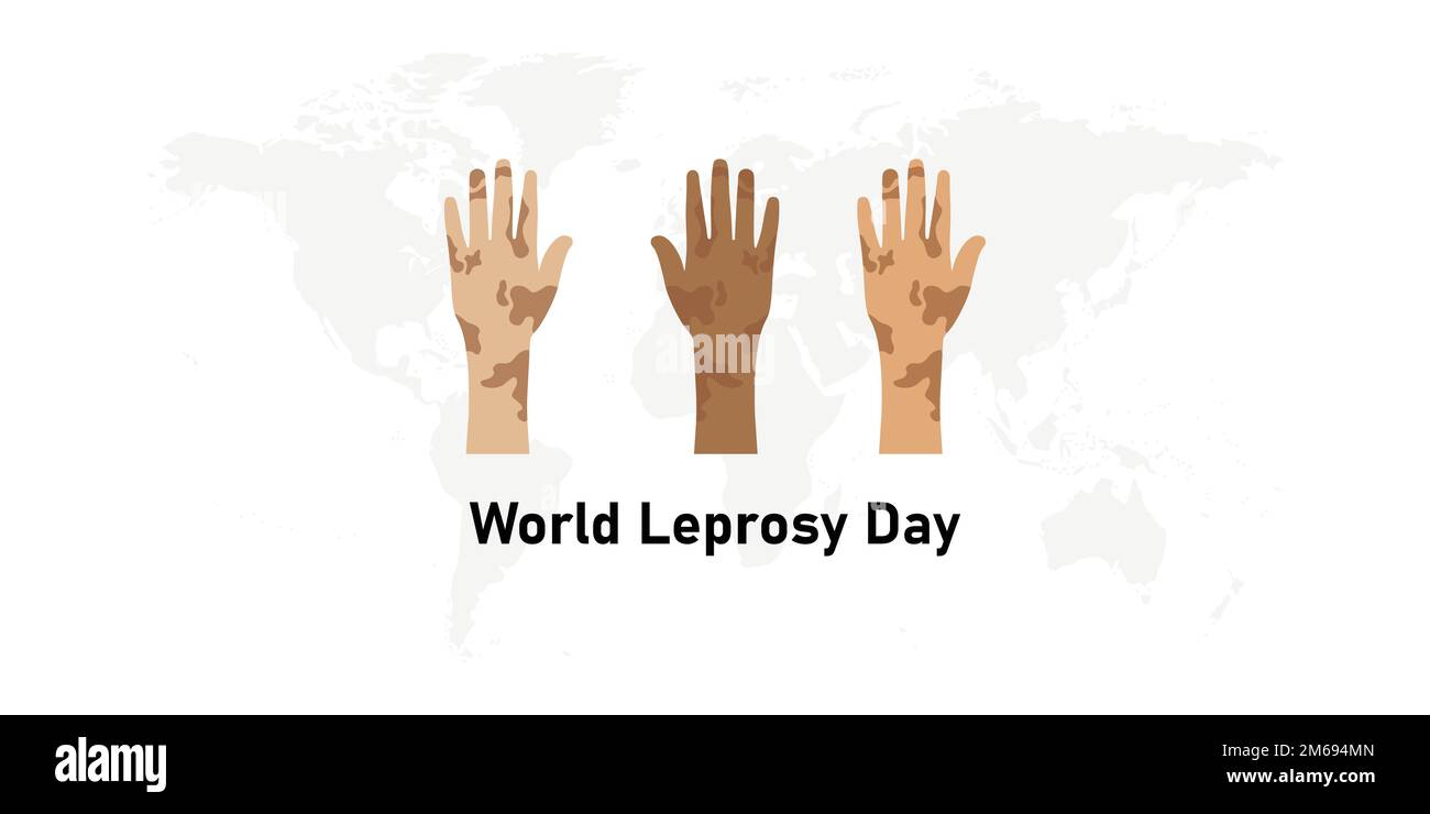 World Leprosy Day Concept Design. Vector Illustration Stock Vector ...