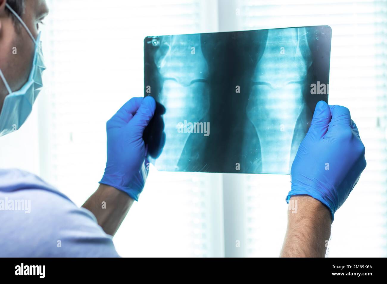 Doctor hold in hands x-ray film. OA knee x-ray image Posteo-anterior ...