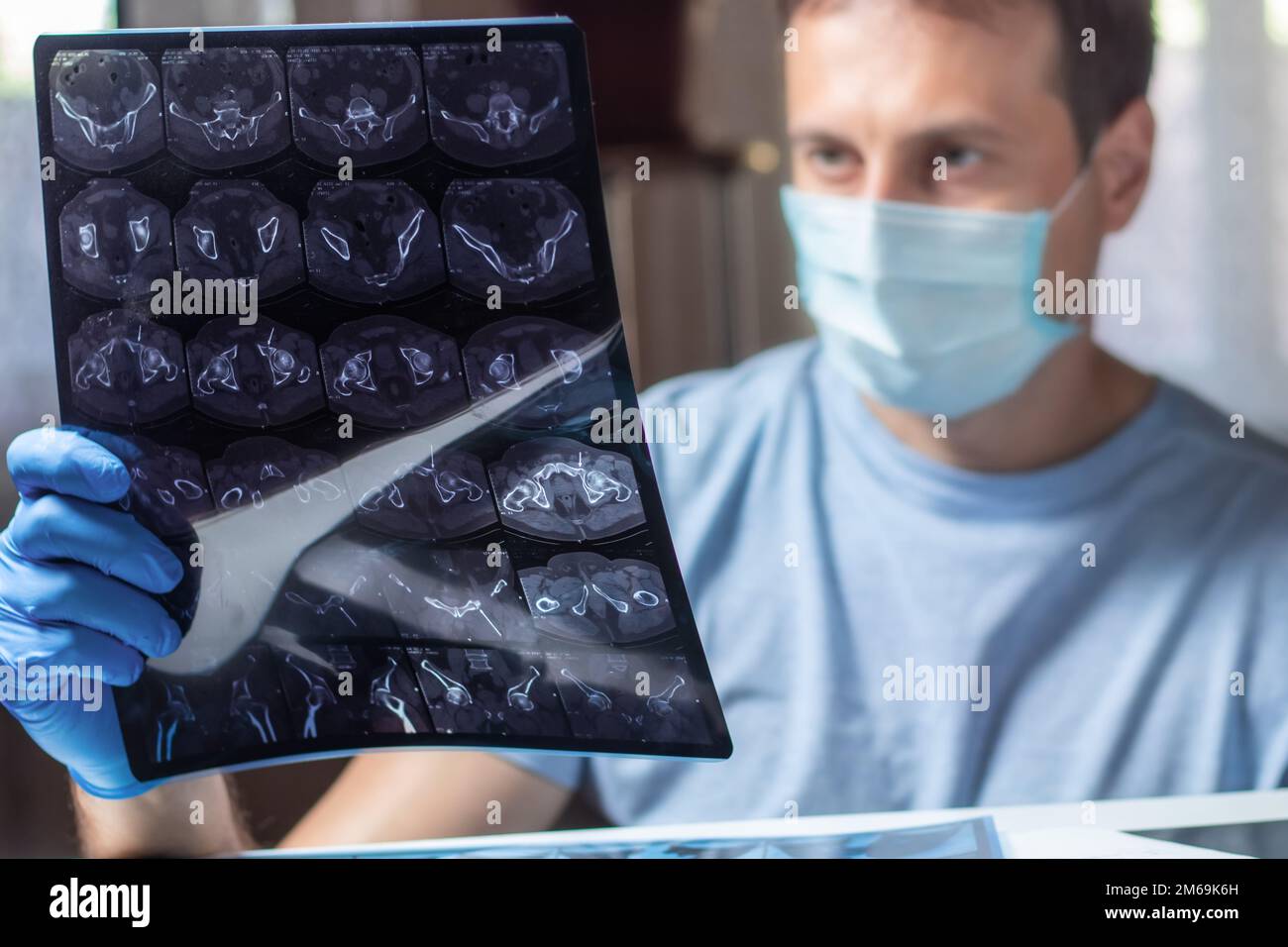 Doctor attentively examines the MRI scan of the patient Stock Photo - Alamy
