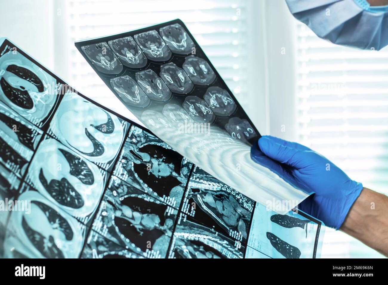 Negative scans hi-res stock photography and images - Alamy