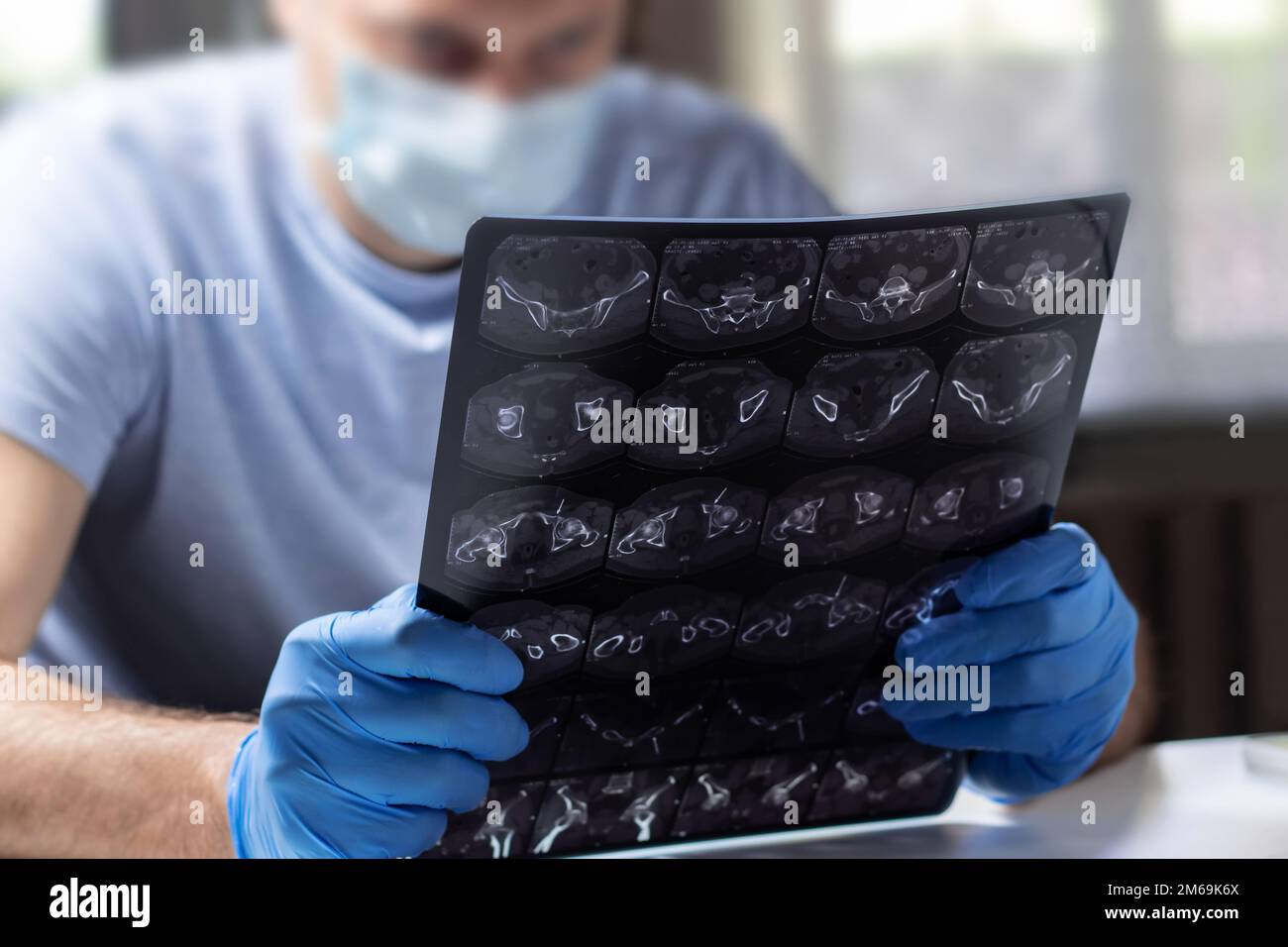 Doctor examining head MRI image in hospital Stock Photo - Alamy