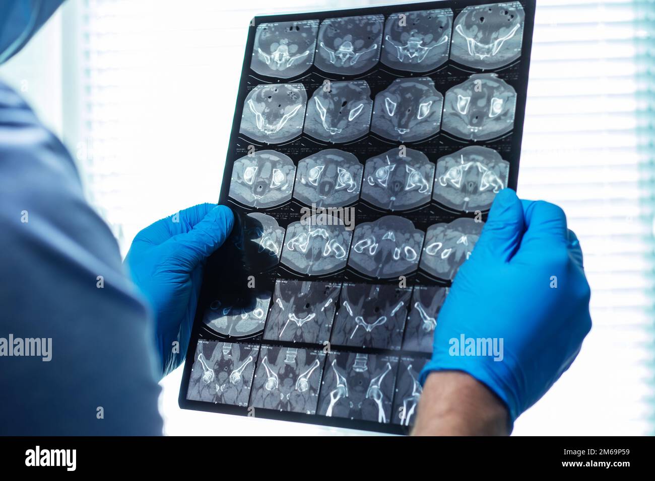 Man doctor in mask examines head MRI in hospital Stock Photo - Alamy