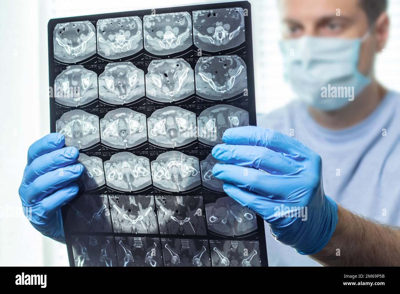 Mri scan man head hi-res stock photography and images - Alamy