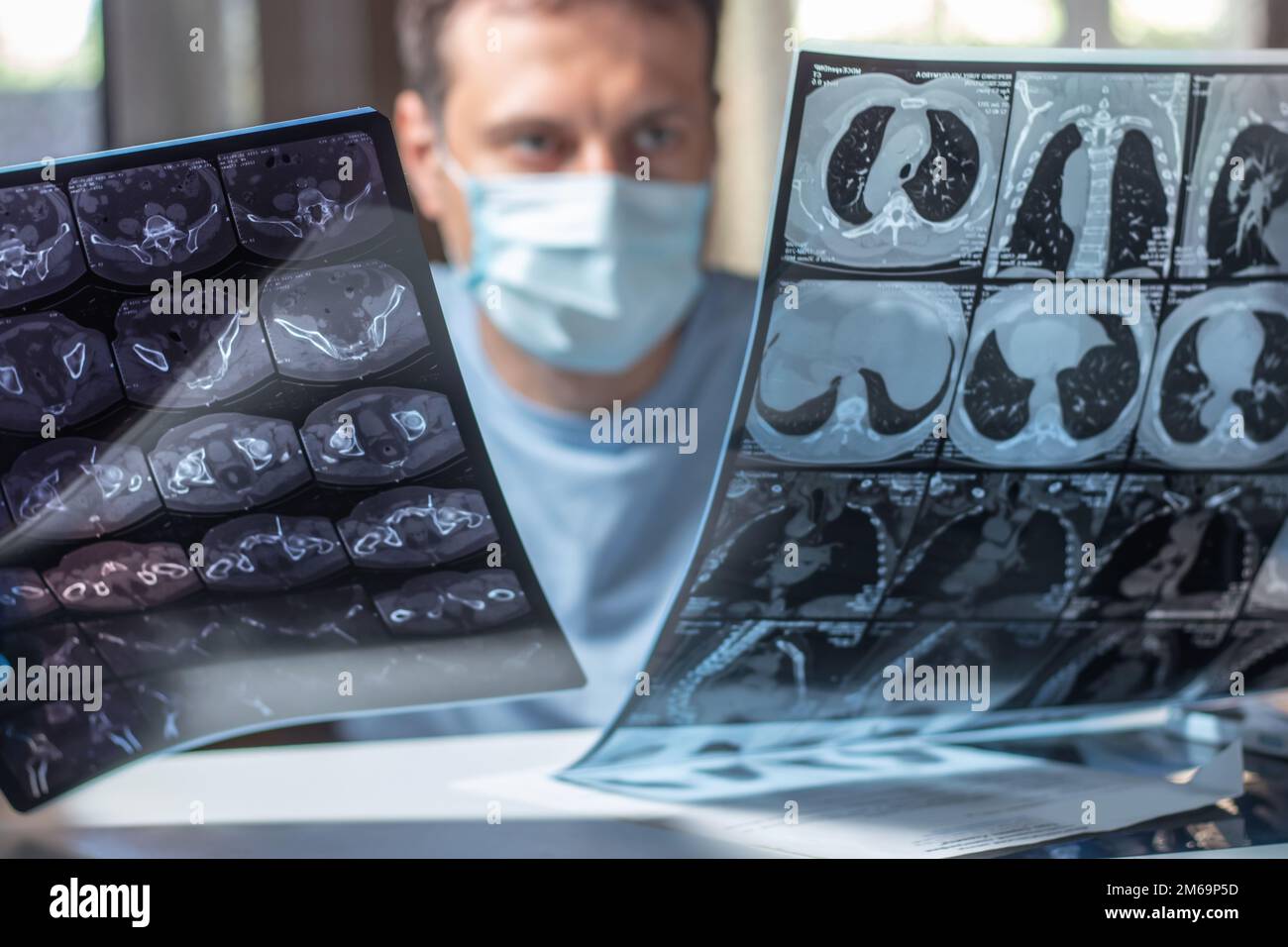Doctor in mask examines and compares two MRI scans Stock Photo - Alamy