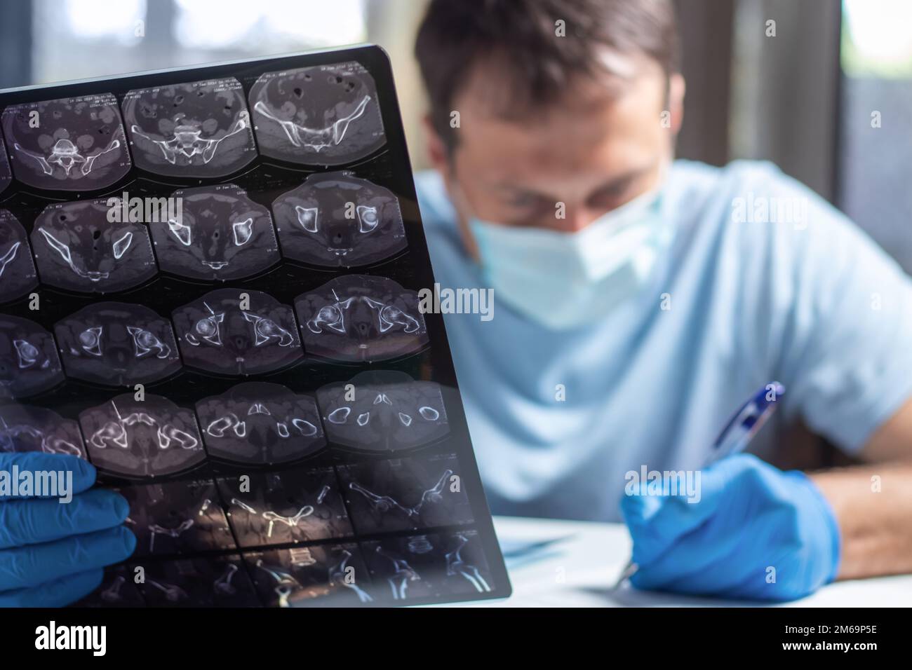 Doctor attentively examines the MRI scan of the patient and writes data ...