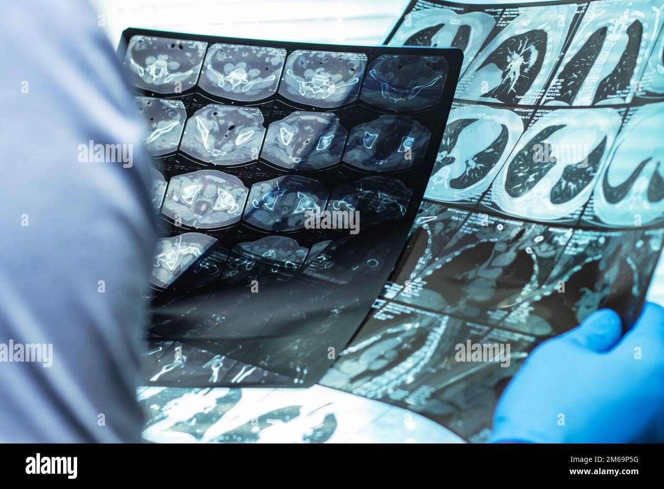Doctor in mask examines and compares two MRI scans Stock Photo - Alamy