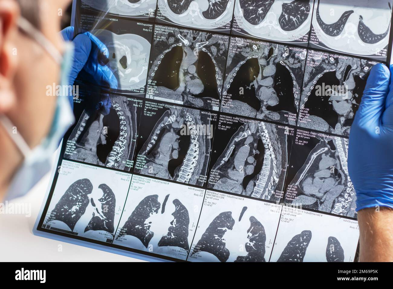 Doctor examining head MRI image in hospital Stock Photo - Alamy