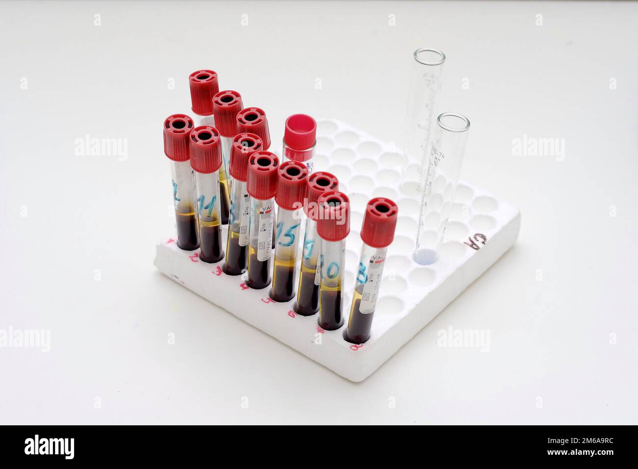 Biochemical test hi-res stock photography and images - Alamy