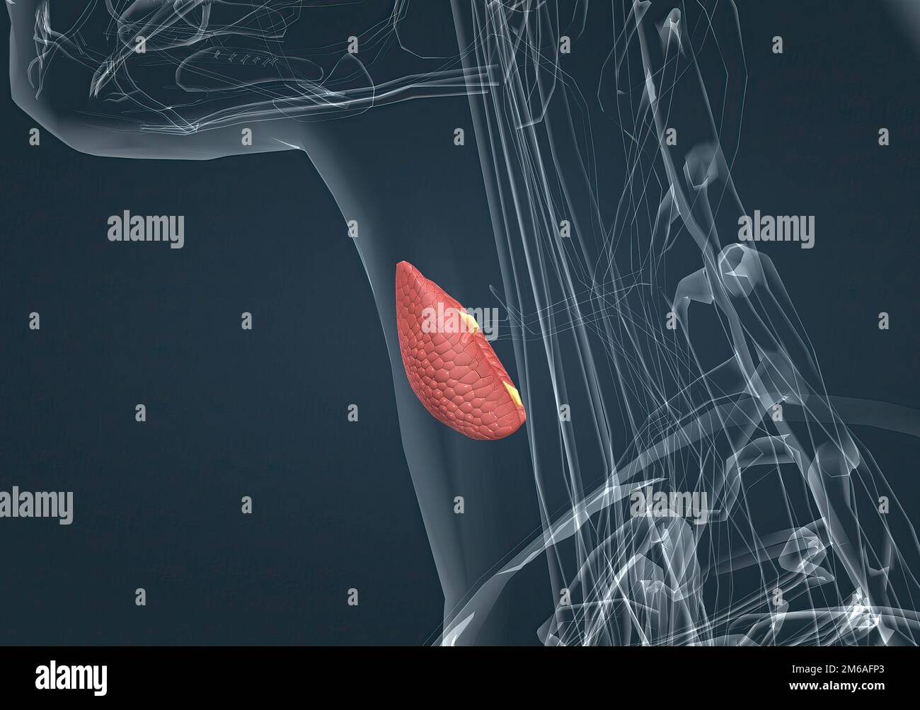 Multinodular toxic goiter hi-res stock photography and images - Alamy