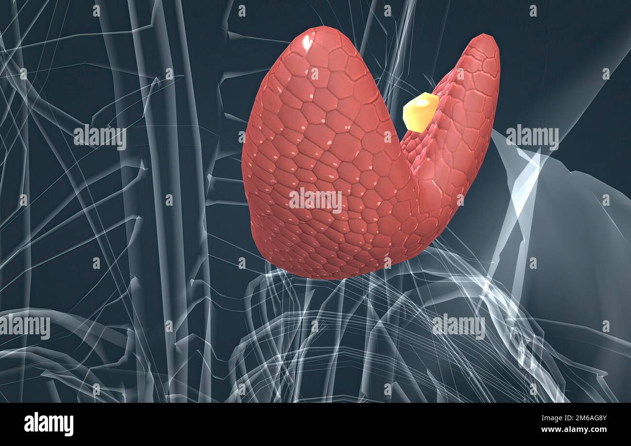 Multinodular toxic goiter hi-res stock photography and images - Alamy