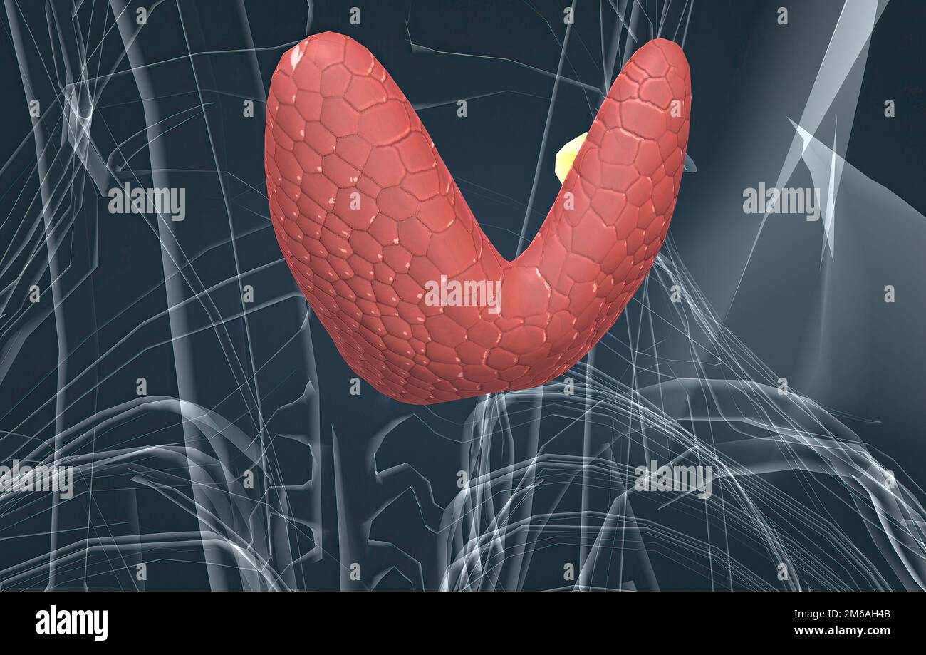 Multinodular toxic goiter hi-res stock photography and images - Alamy