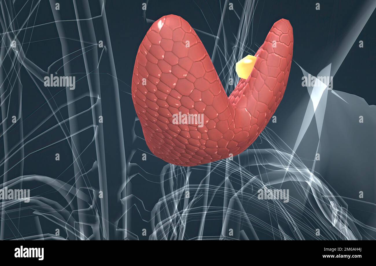 Multinodular goiter hi-res stock photography and images - Alamy