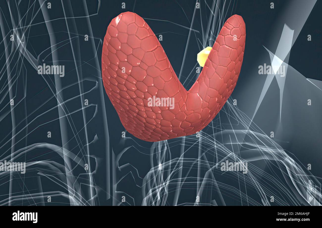 Multinodular goiter hi-res stock photography and images - Alamy