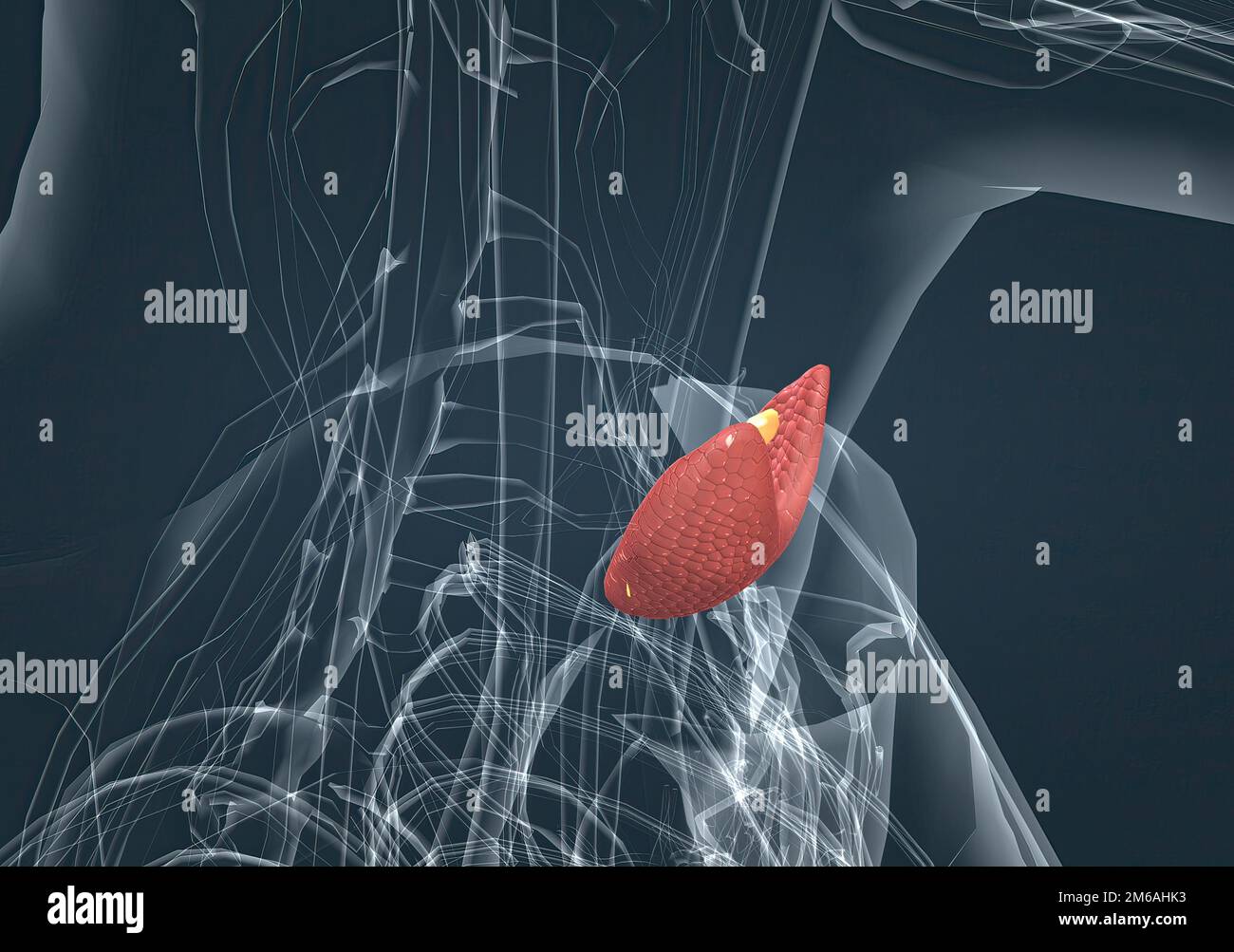 Multinodular toxic goiter hi-res stock photography and images - Alamy