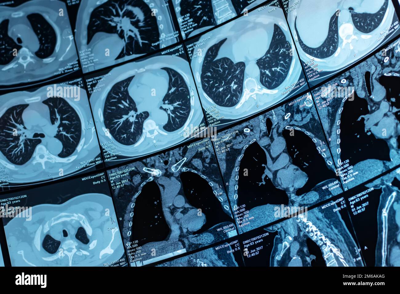 Close up of a body CT scan background Stock Photo - Alamy
