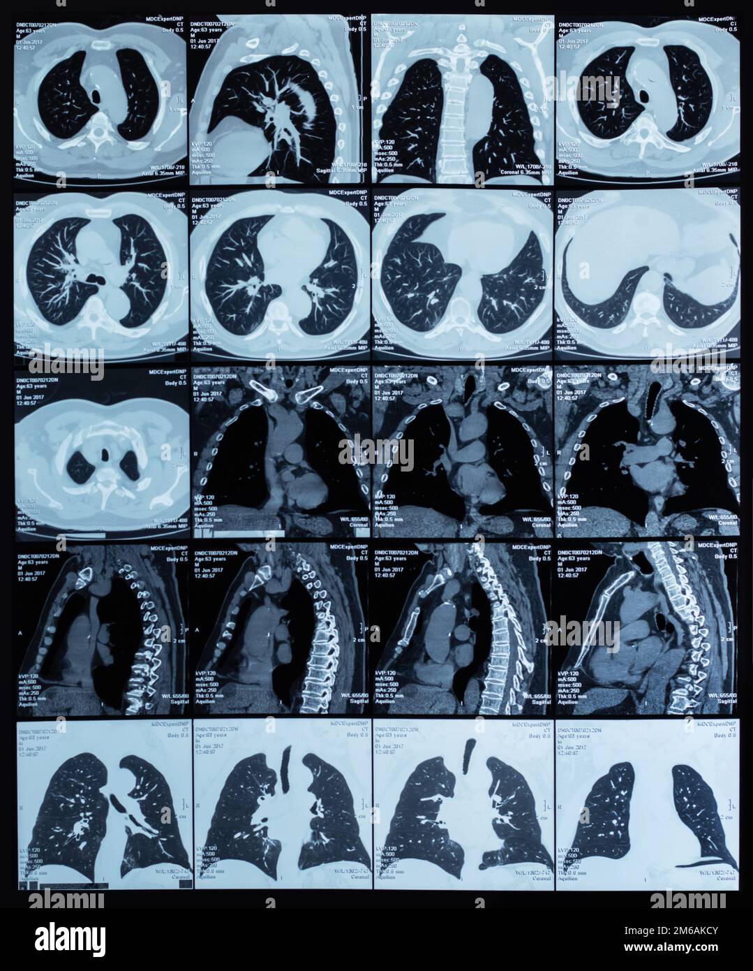 Close up of a body CT scan background Stock Photo - Alamy