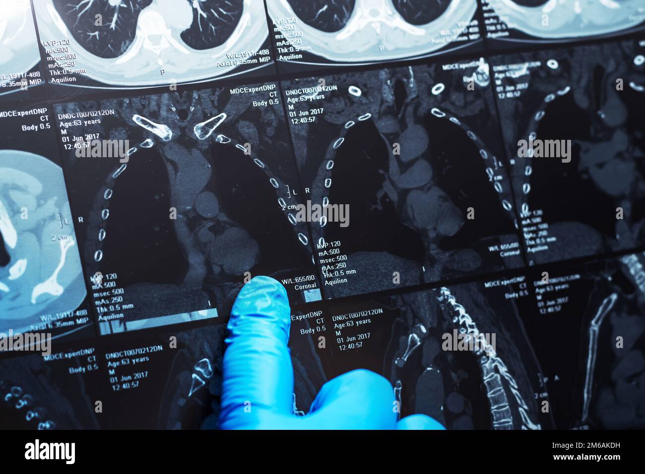 Doctor attentively examines the MRI scan of the patient Stock Photo - Alamy