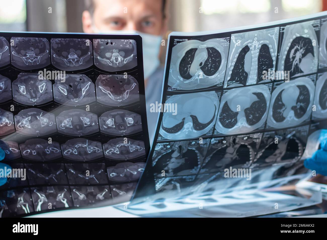Doctor in mask examines and compares two MRI scans Stock Photo - Alamy