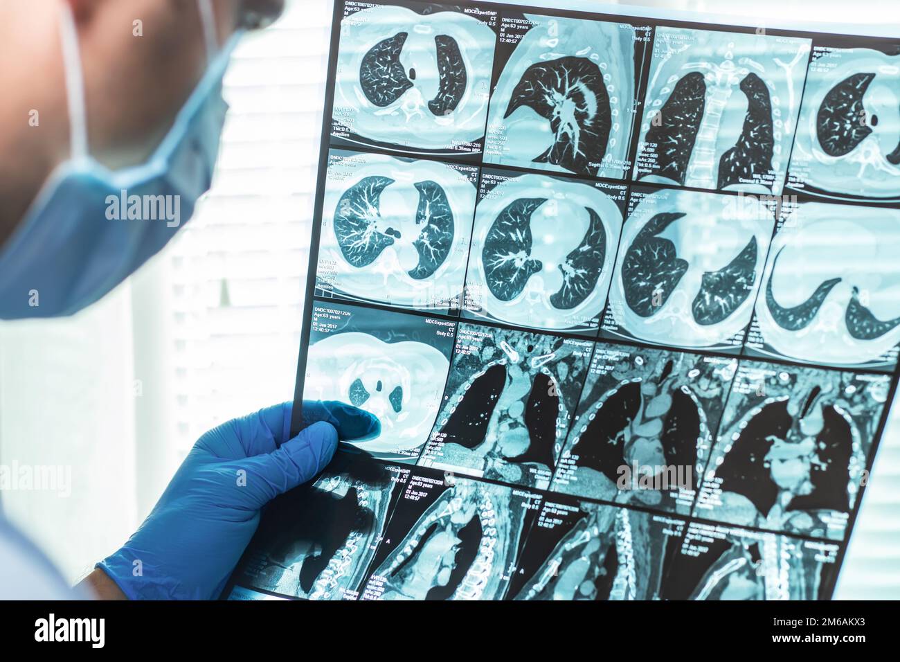 Doctor examining MRI image in hospital Stock Photo - Alamy