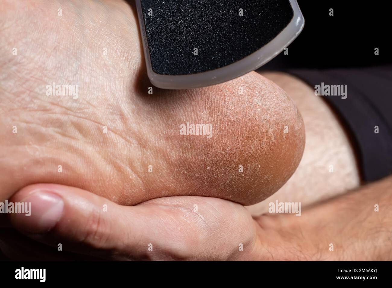 Close up of man's heels holding a heel brush. Natural gray pumice stone ...