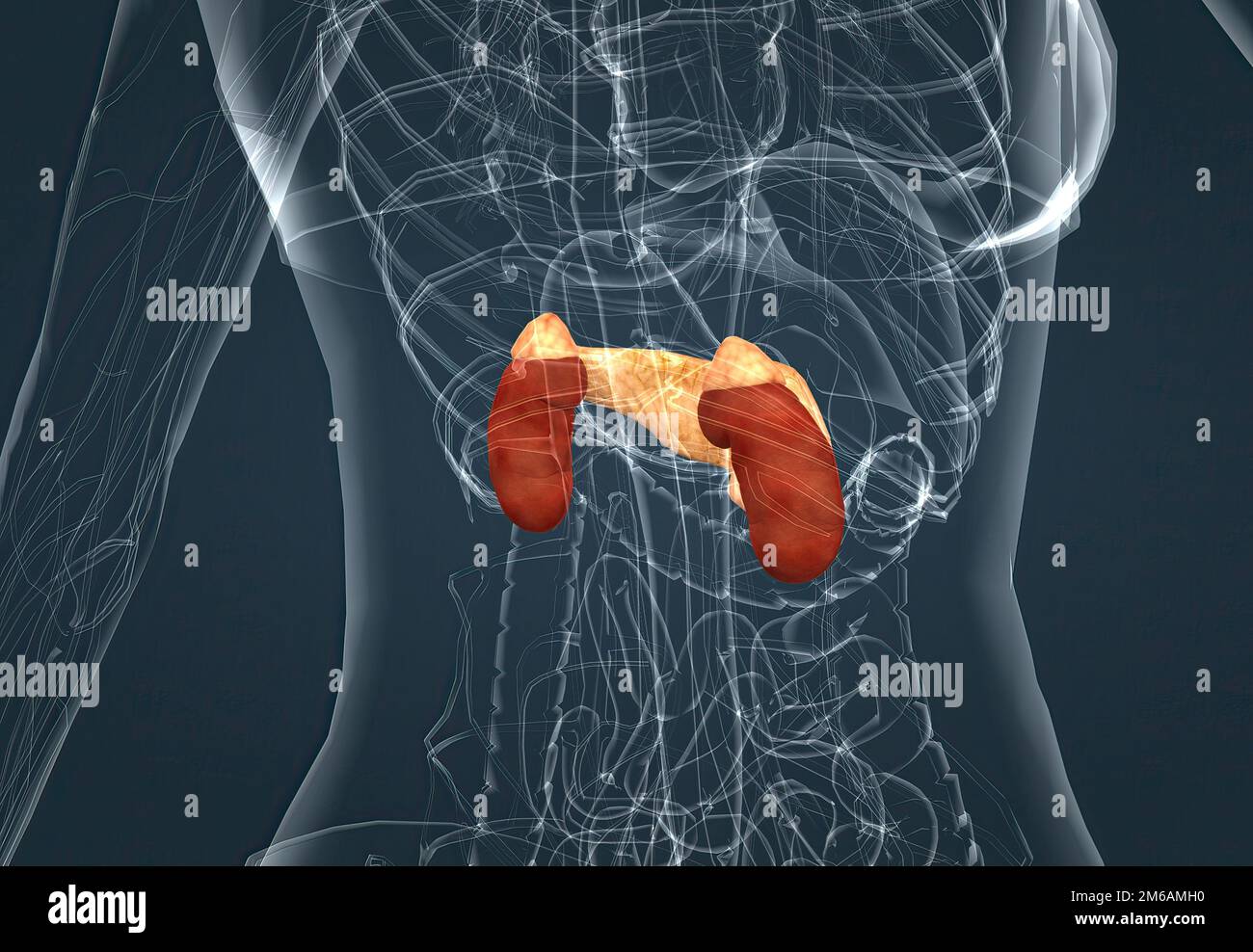 Multinodular toxic goiter hi-res stock photography and images - Alamy