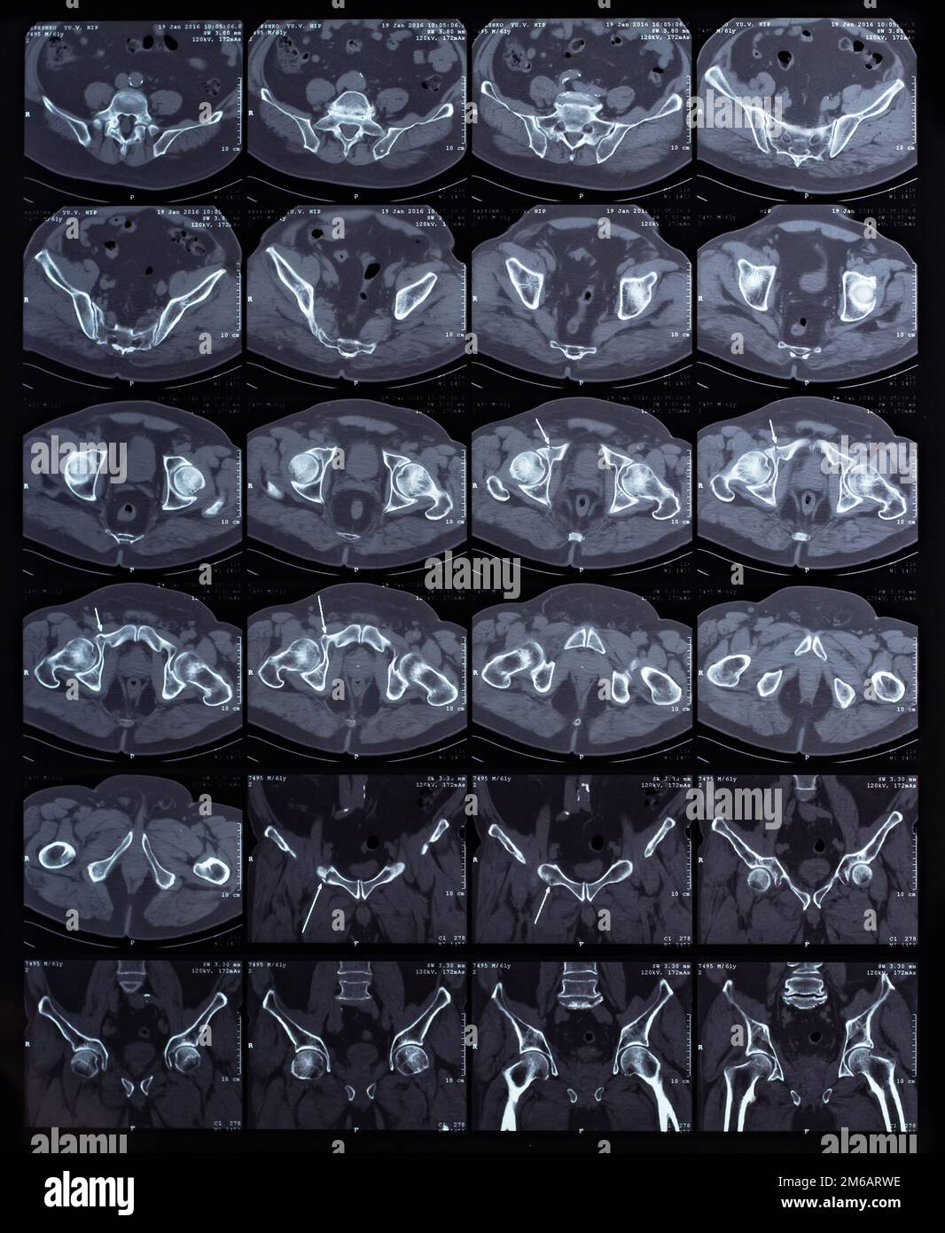 Close up of a body CT scan background Stock Photo - Alamy