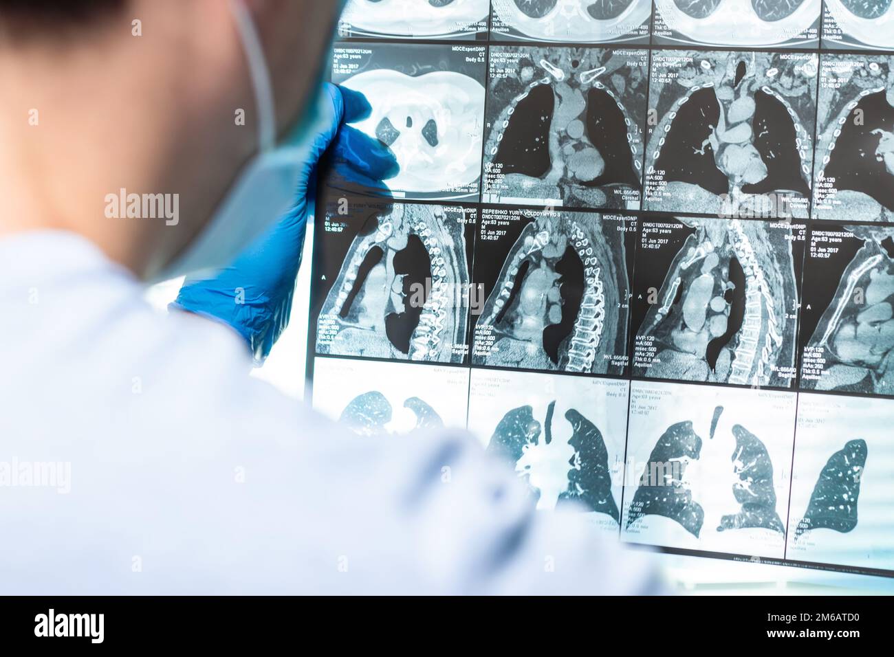 Doctor attentively examines the MRI scan of the patient Stock Photo - Alamy