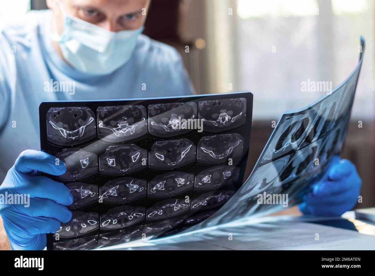 Doctor in mask examines and compares two MRI scans Stock Photo - Alamy