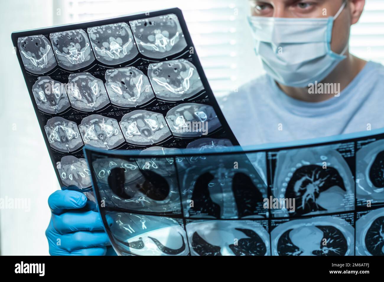 Doctor in mask examines and compares two MRI scans Stock Photo - Alamy