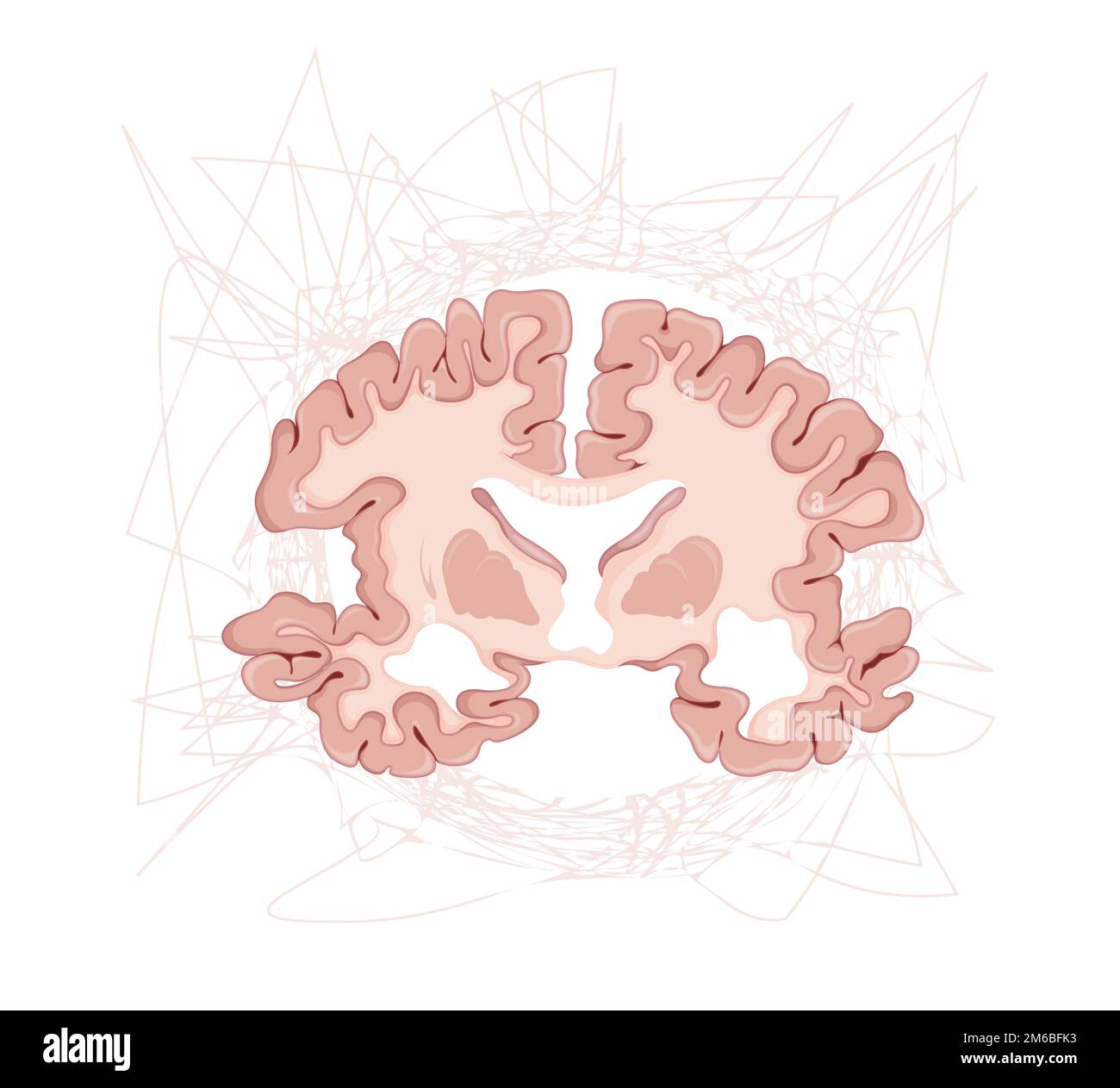 Coronal View Of Brain Blank