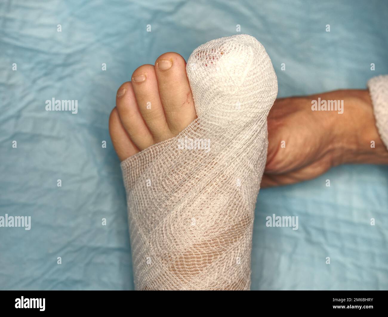 Mum covering with medicine bandage injury foot with hurt big toe Stock ...