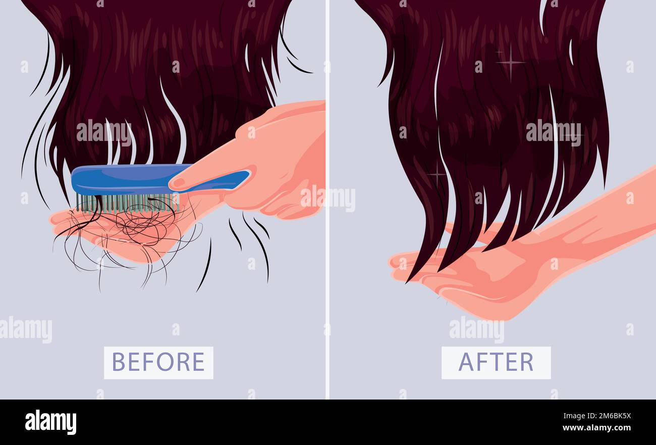 Woman with hair problem, fall, alopecia, damage, vector illustration ...