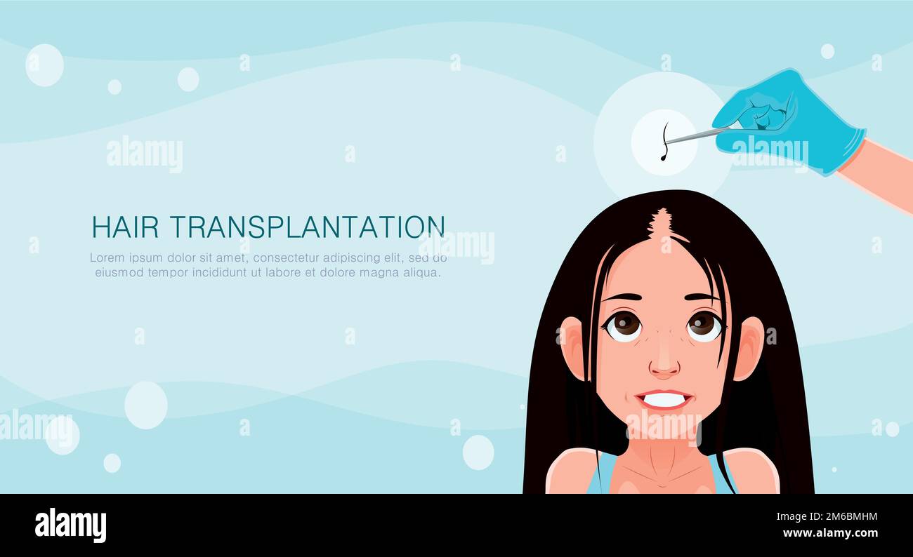 Girl with hair problem, fall, alopecia, damage, Hair transplant ...