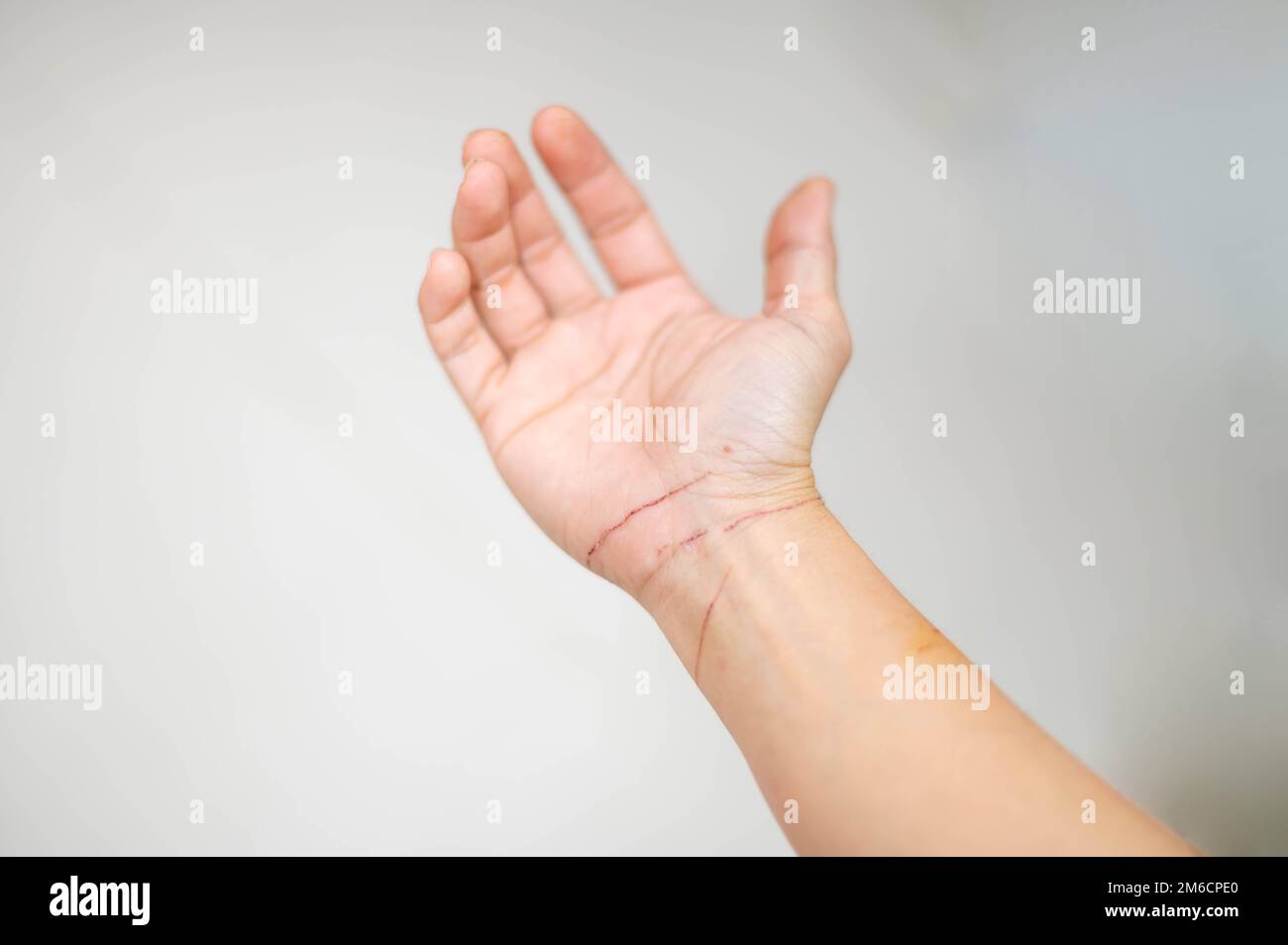 Itching and scratching drawing hi-res stock photography and images - Alamy