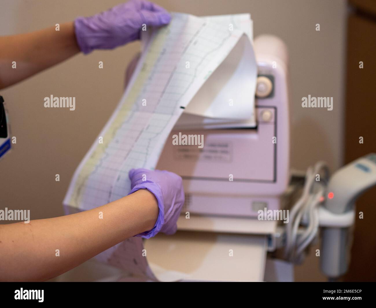 A nurse checking a graph in a hospital Stock Photo - Alamy