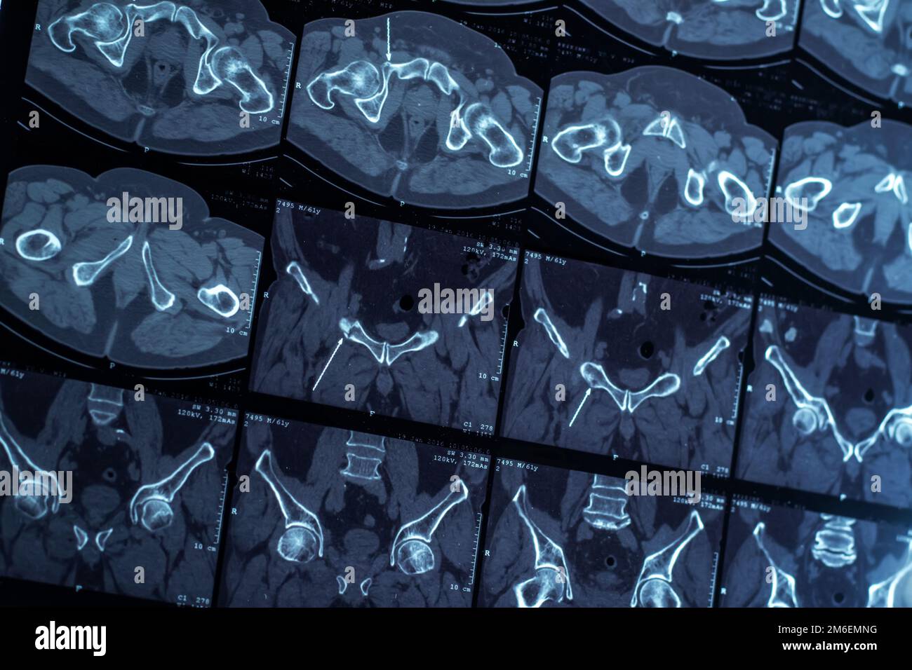 Close up of a body CT scan background Stock Photo - Alamy