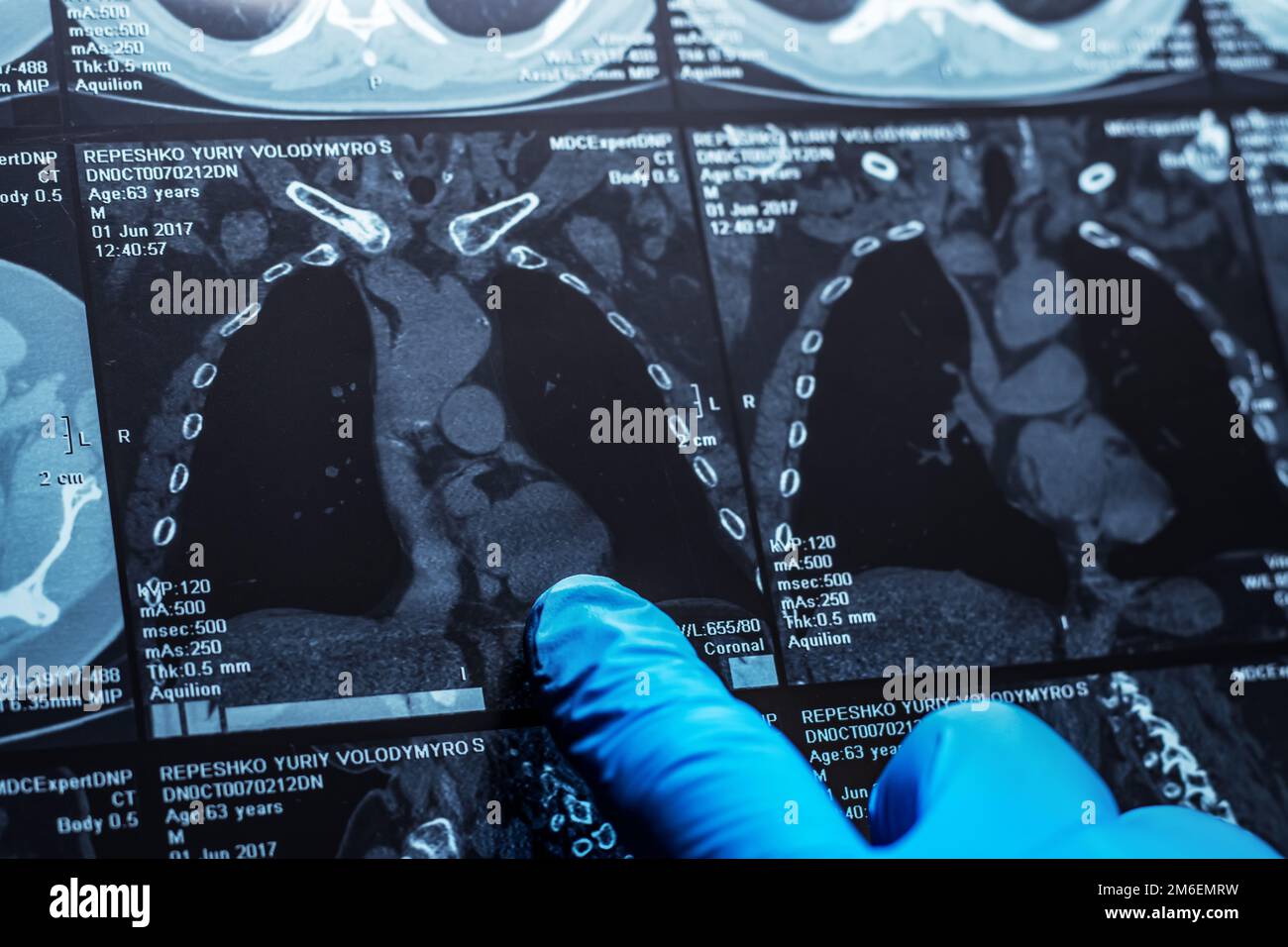Radiologist examines mri scan hi-res stock photography and images - Alamy