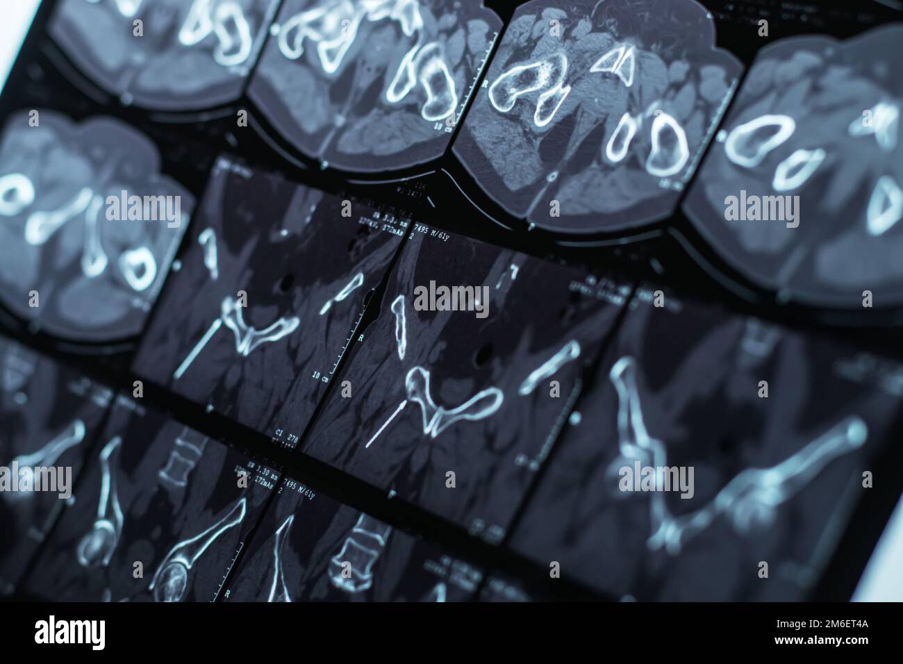 Close up of a body CT scan background Stock Photo - Alamy