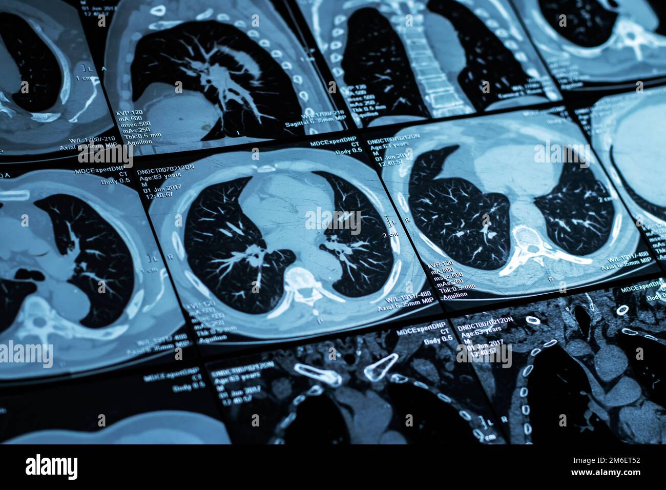Close up of a body CT scan background Stock Photo - Alamy