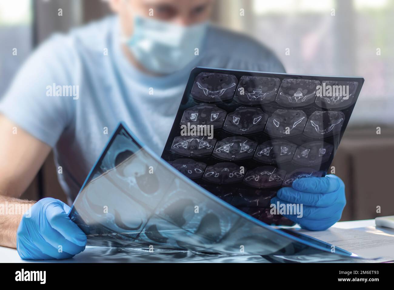 Doctor in mask examines and compares two MRI scans Stock Photo - Alamy