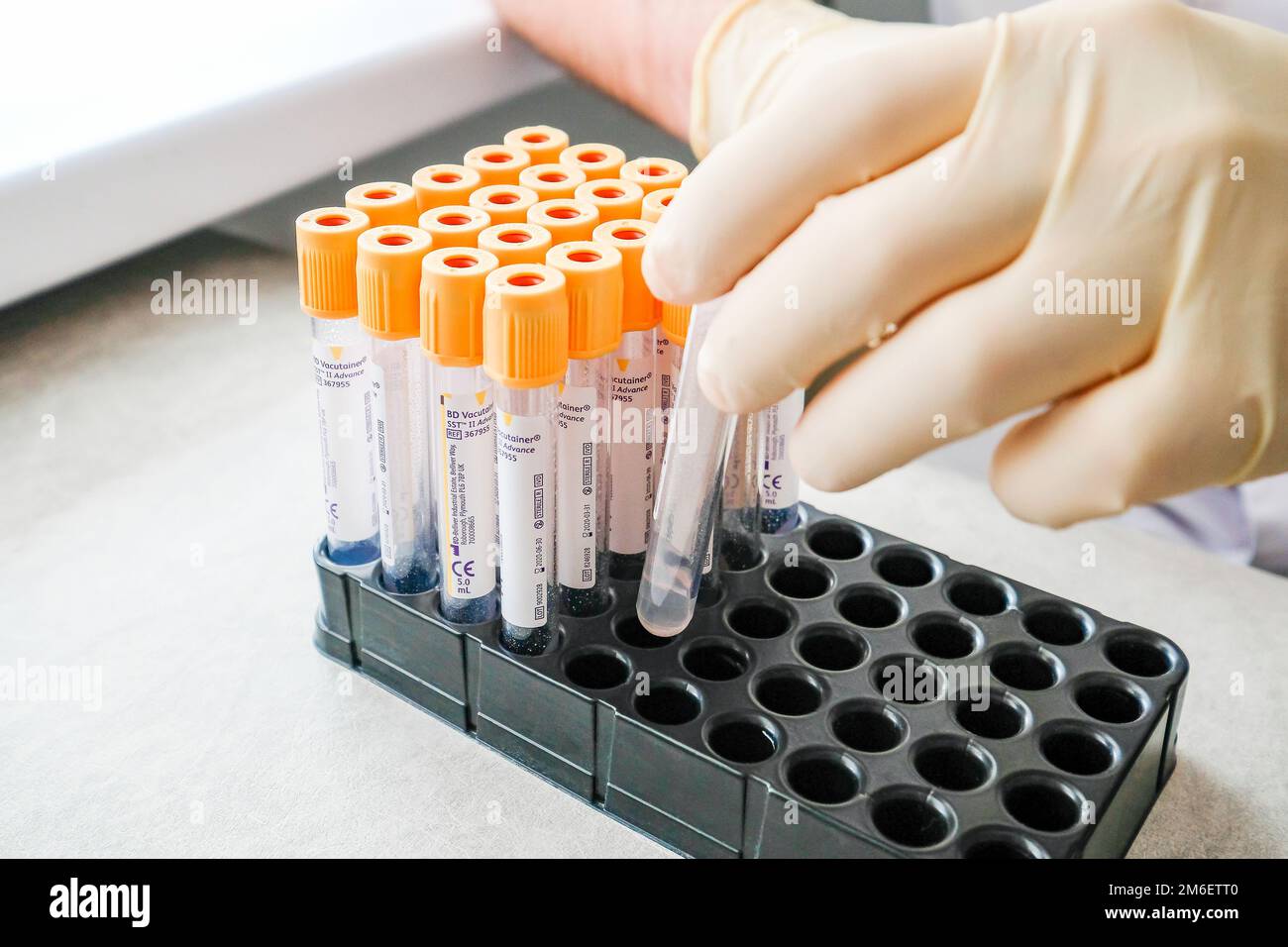 Vacuum tubes medical hi-res stock photography and images - Alamy