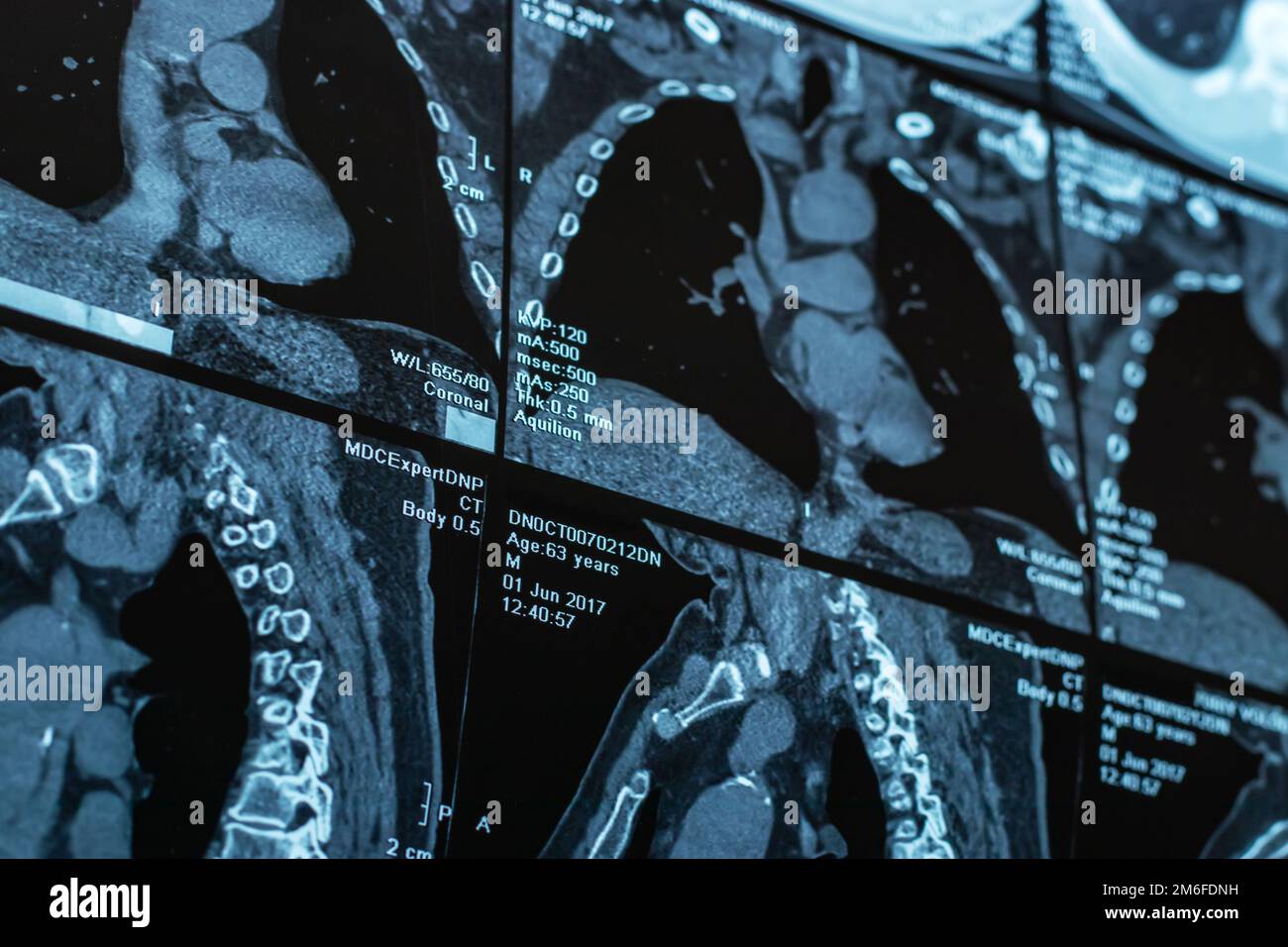 Close up of a body CT scan background Stock Photo - Alamy
