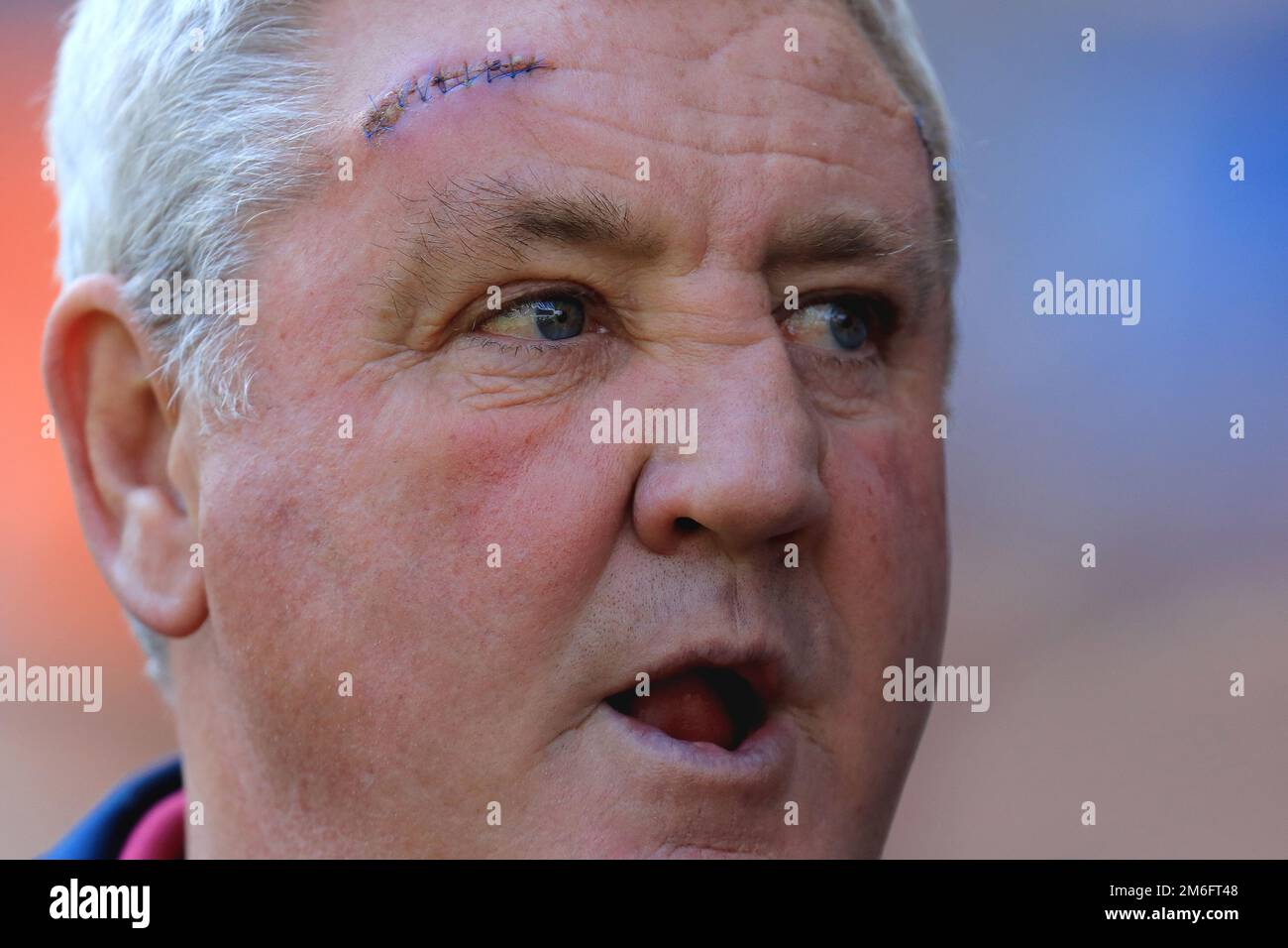 With stitches on his forehead hi-res stock photography and images - Alamy