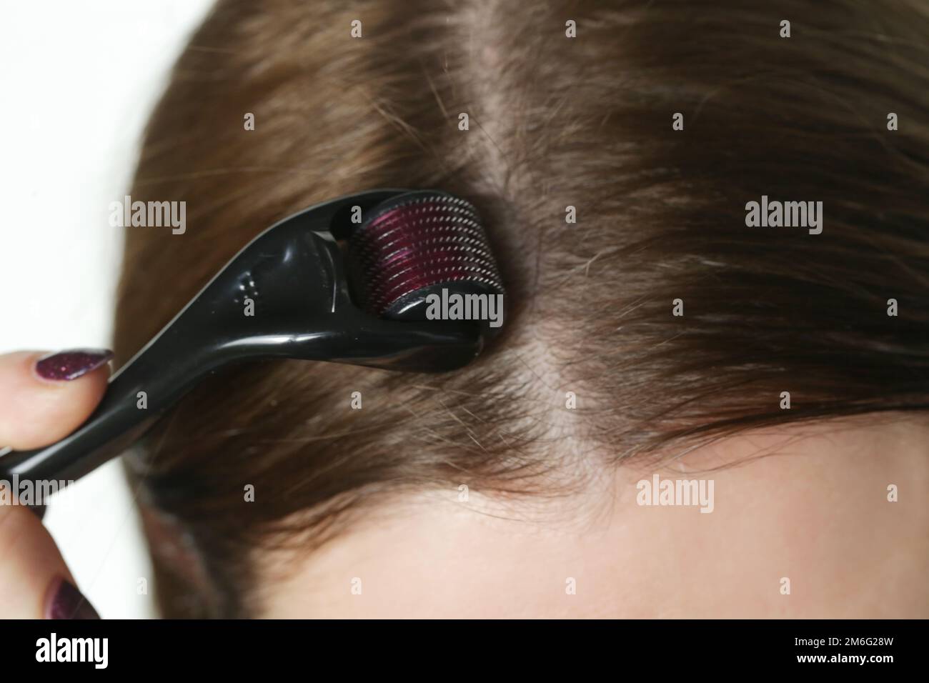 Woman using microneedle derma roller on head for stimulating new hair ...