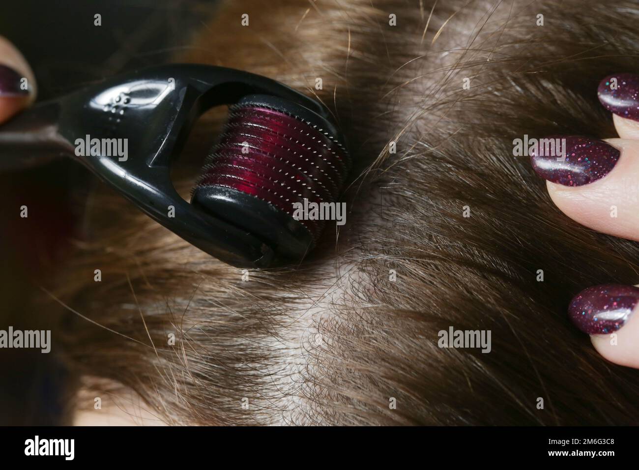 Woman using microneedle derma roller on head for stimulating new hair ...