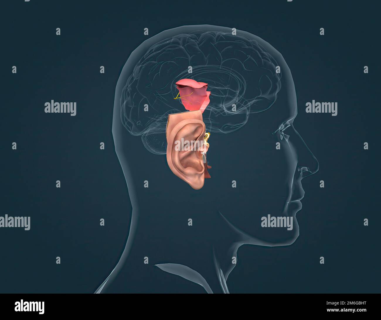 Paracentesis of the eardrum hi-res stock photography and images - Alamy
