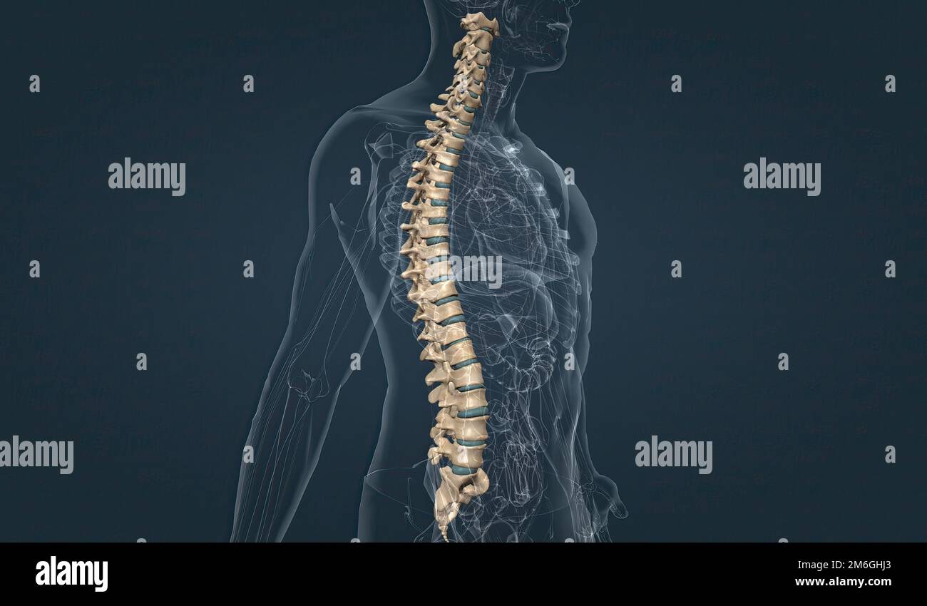 Fused vertebrae hi-res stock photography and images - Alamy