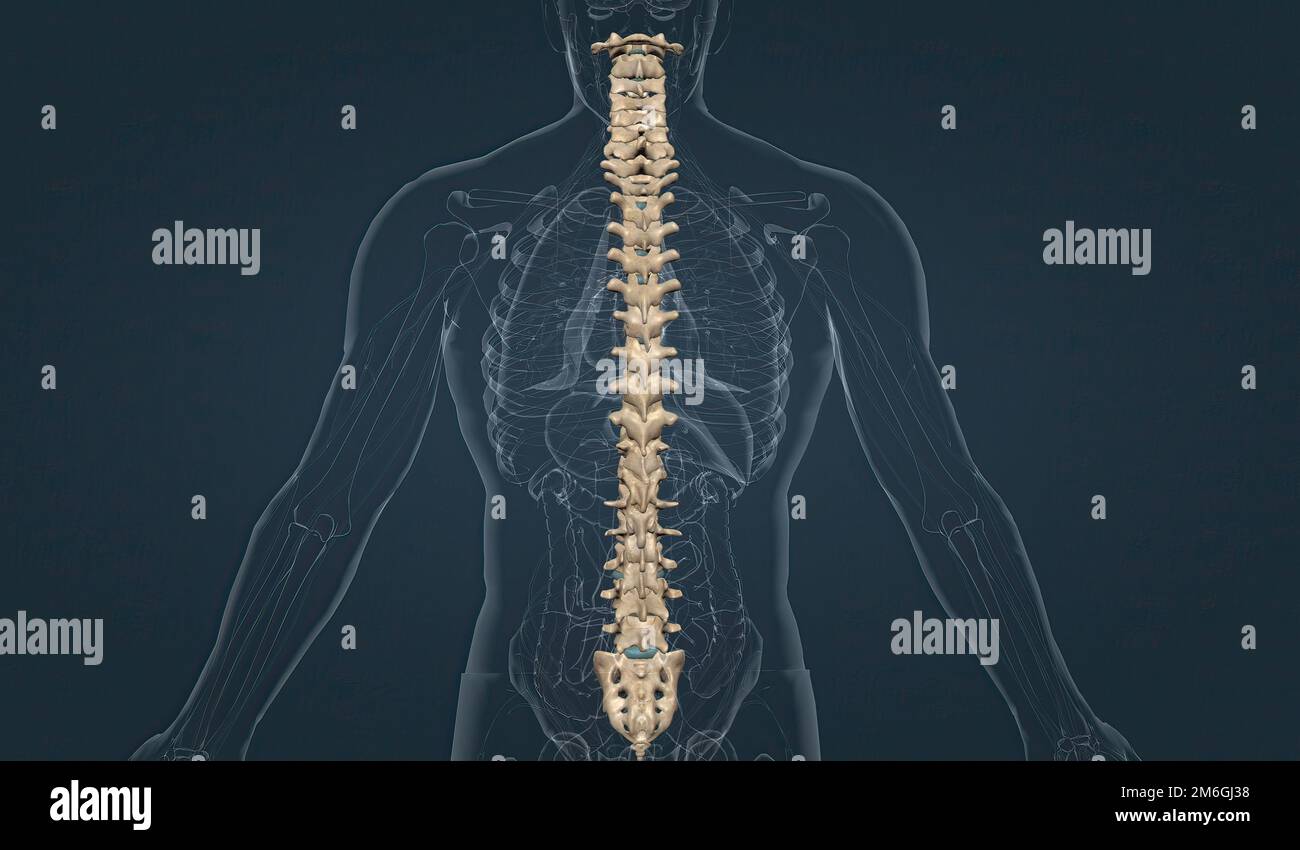 Fused vertebrae hi-res stock photography and images - Alamy