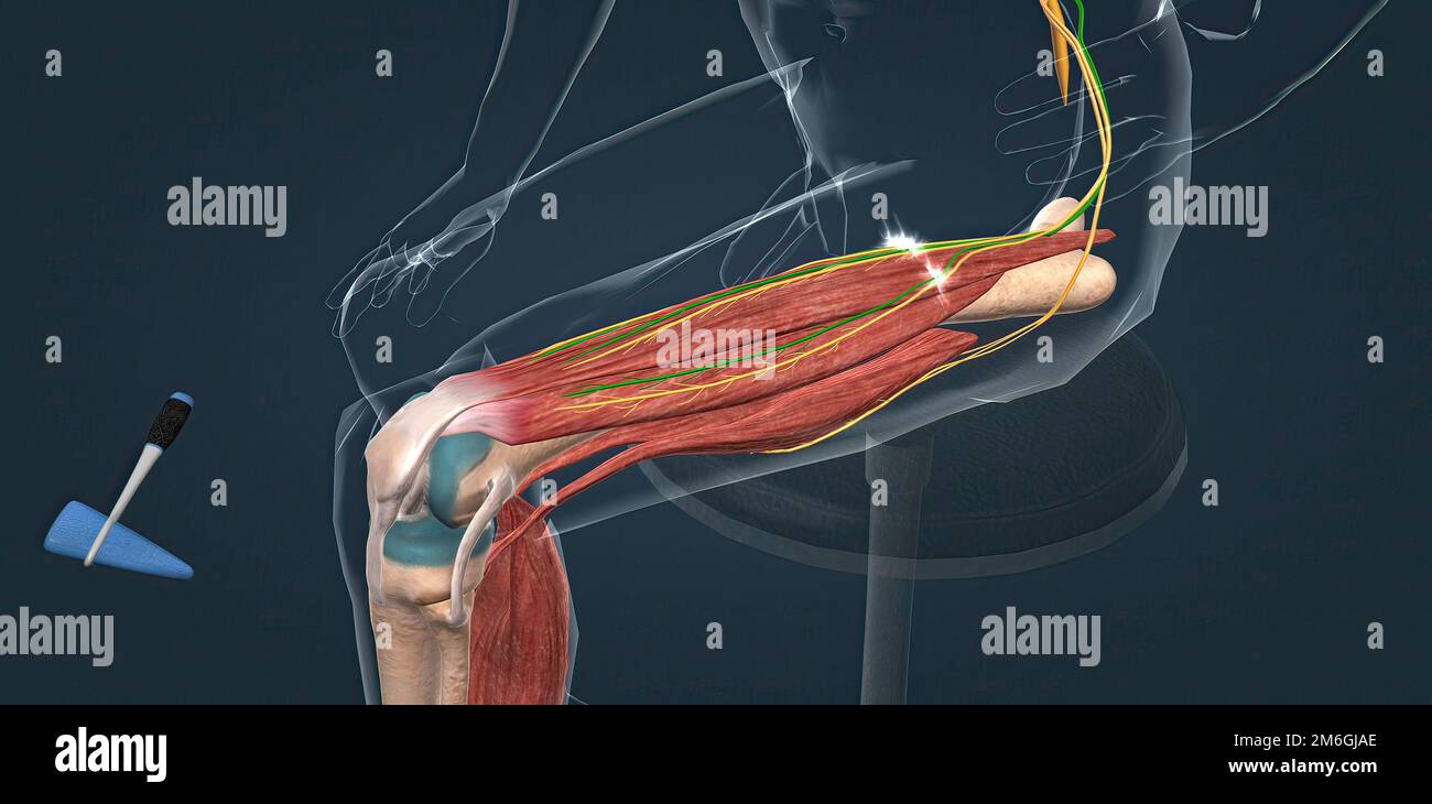 Postural reflex hi-res stock photography and images - Alamy